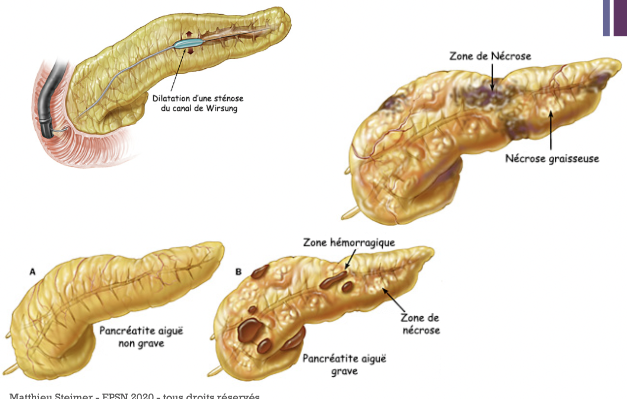 Pathologies digestives - Mind Map