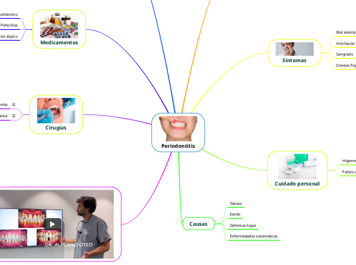 Periodontitis - Mind Map