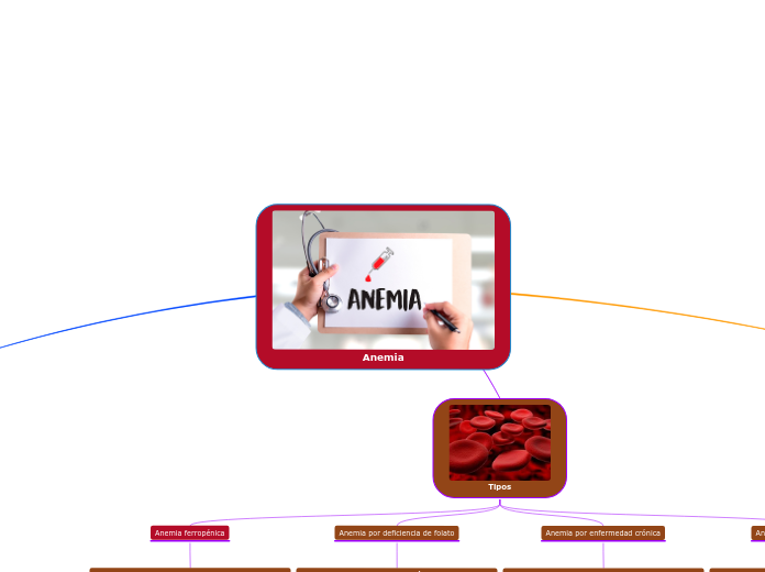 Anemia - Mind Map