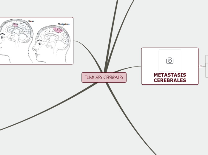 neuro - Mind Map