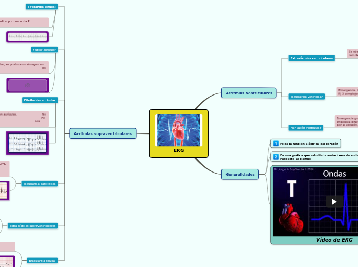 EKG cardio - Mind Map