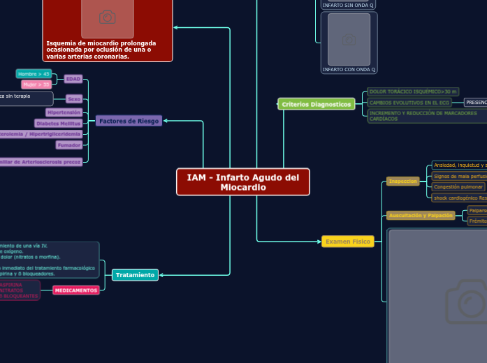 IAM - Infarto Agudo del Miocardio - Mind Map