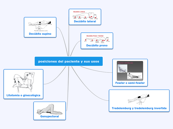 posiciones del paciente y sus usos - Mind Map