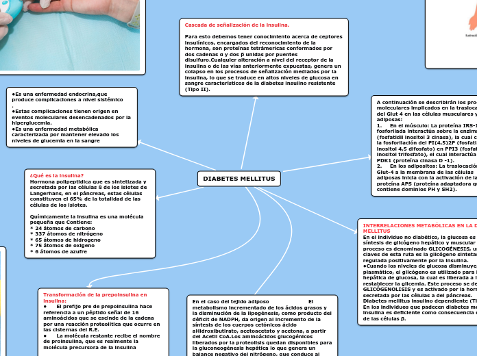 DIABETES MELLITUS - Mind Map