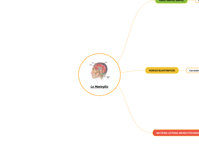La Meningitis - Mind Map